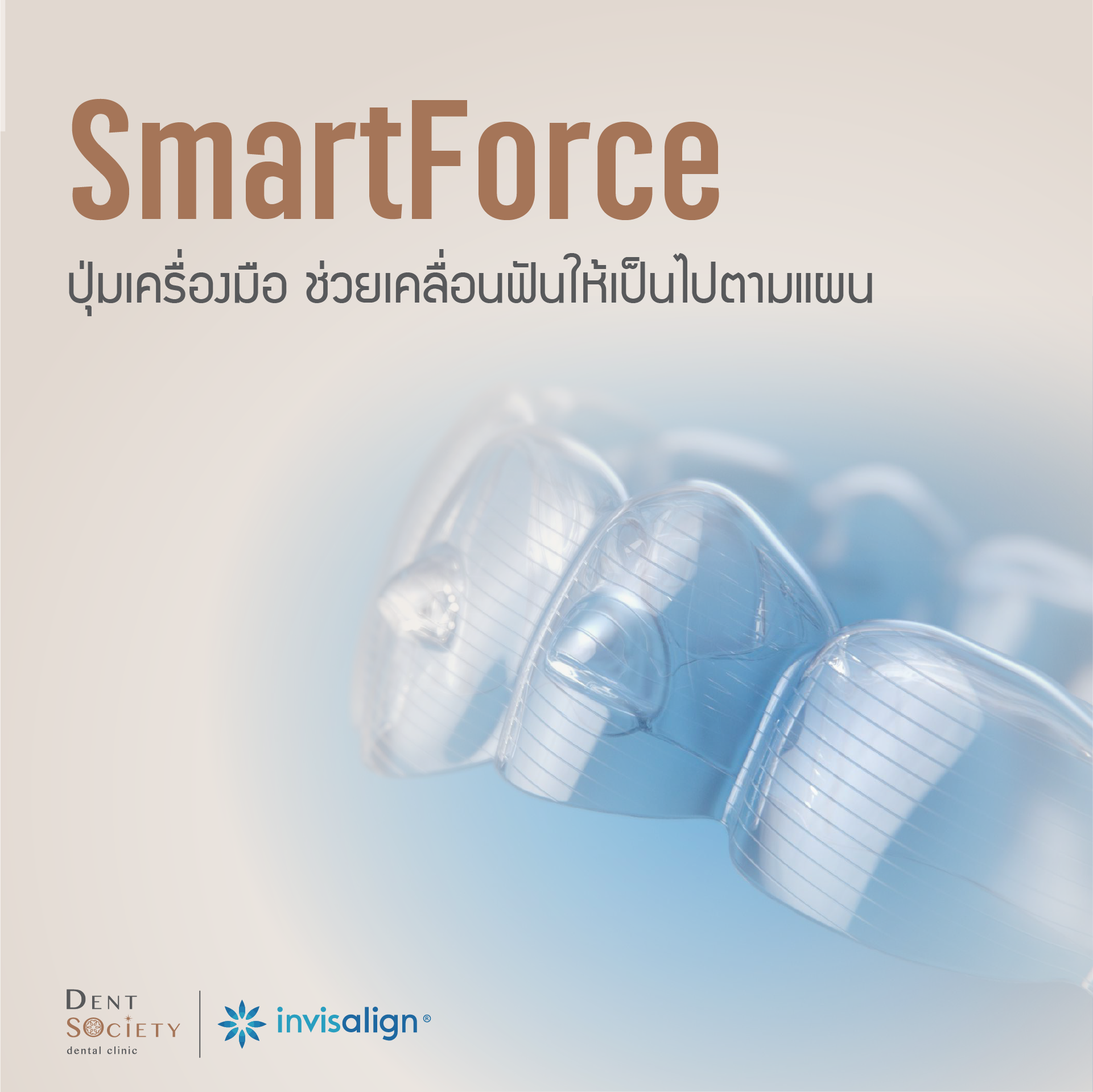 จัดฟันใส Invisalign clear aligner - DentSocietyclinic